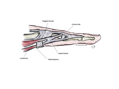 Extensor tendon anatomy lateral view - James Henderson - Specialist ...