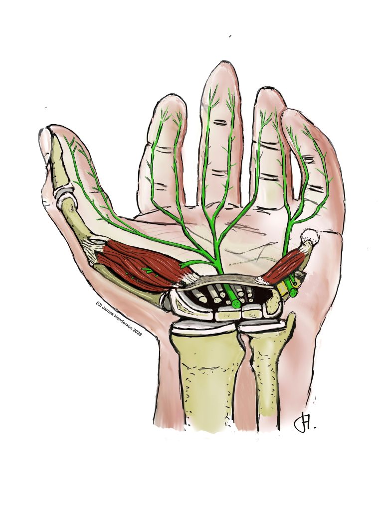 Diagrams for doctors and patients