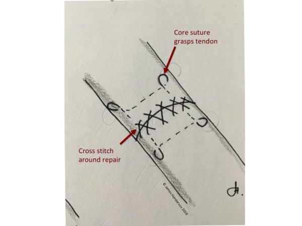 Diagrams for doctors and patients