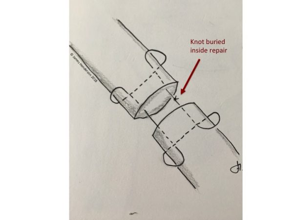 Diagrams for doctors and patients